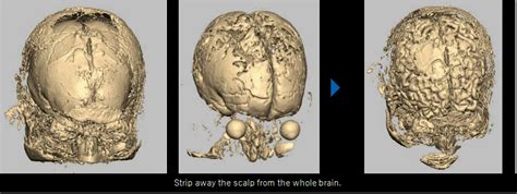 converting a dicom file to a 3d model yasojima proceed co ltd