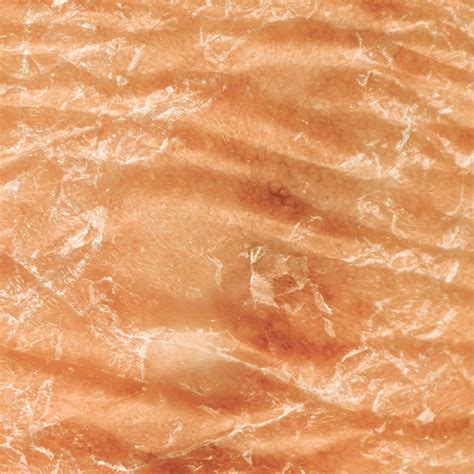 Xerosis Cutis Definition Causes And Treatments Bioderma Us