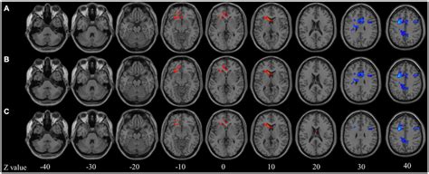 Seed Based Functional Connectivity Analysis A Age Model B