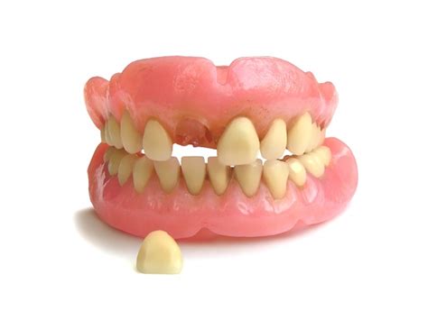 Partial Denture Options For Replacing Missing Teeth Hemet Dental Center Brian Stiewel Dds