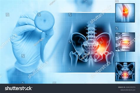 Osteoarthritis Check Over 33 Royalty Free Licensable Stock Illustrations And Drawings Shutterstock