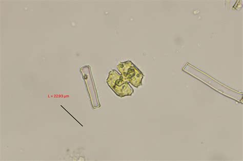 Xanthidium The Microscopic Life Of Shetland Lochs