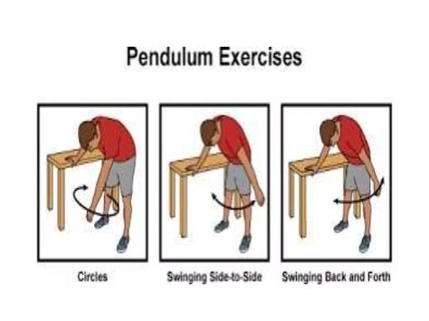 Humerus Shaft Fractur OSCE Pptx