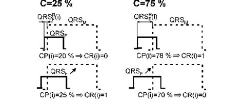 The Influence Of A Change Of Fetal QRS Width On The Coincidence Download Scientific Diagram