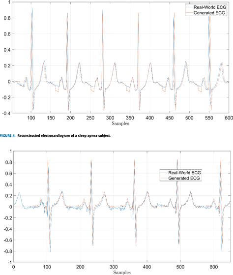 Figure From On A Novel Model For ECG Signals And Its Statistical Properties Semantic Scholar