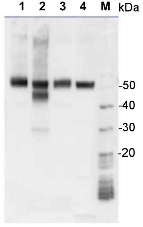 Anti Rbcl Rubisco Large Subunit Form Iplastid Stroma Chicken