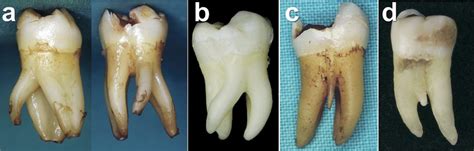 The Endo Expert The Radix Dentistry Online