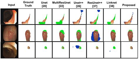 Visual Representation Of The Input Colonoscopic Images And The