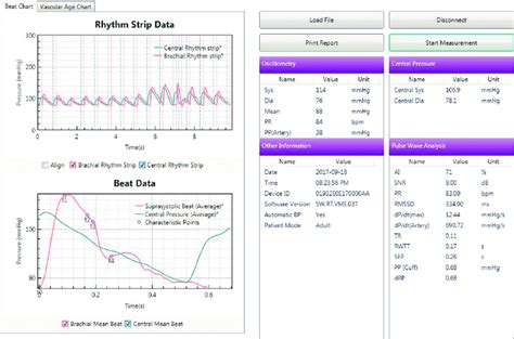 3 T D D I F F Methodology Of Pulse Wave Analysis With Download Scientific Diagram