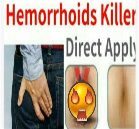 Almoranas Treatment Stop Almoranas Ganozhi Herbal Cream 🤔dumudugo Ba