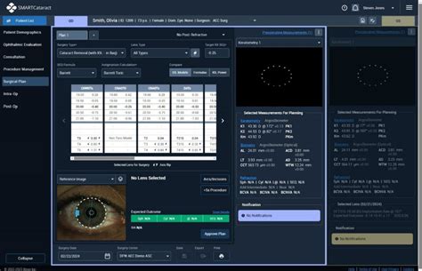 Smartcataract Improving The Workflow With Refractive Cataract Surgery Planning Ophthalmology