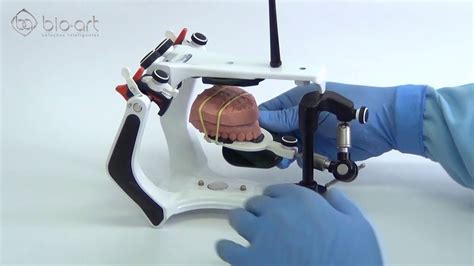 Registro Del Arco Facial Y Montaje En Articulador Semiajustable Paso 3