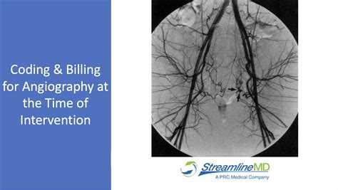 Coding And Billing For Diagnostic Angiography At The Time Of Intervention Streamlinemd