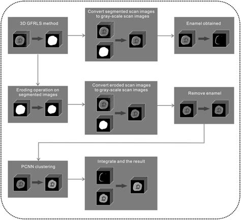 An Automatic Segmentation And Classification Framework Based On Pcnn Model For Single Tooth In