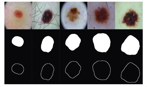 Samples Of Test Images Their Segmentations Using U Net And Borders