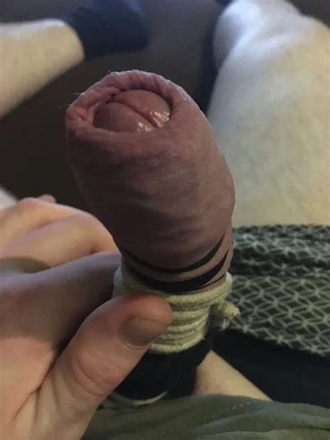 Cock And Ball Bondage 31 Pics Xhamster