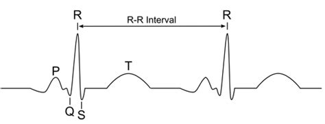 Cardiac Physiology And Ecg Lab Ch 13 Flashcards Quizlet