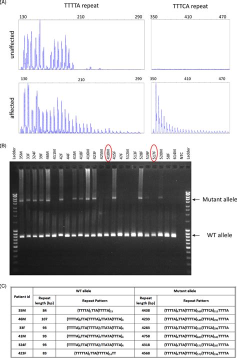 Characterization Of The Mutant Allele By Repeat‐primed And Long‐range