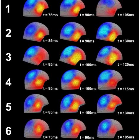 Neural Mass Model Of Jansen And Rit With Excitatory Interneurons Ein