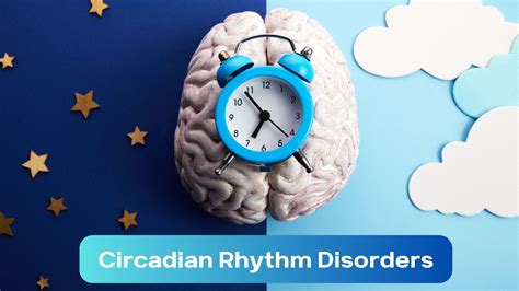 Circadian Rhythm Disorders Solvemyhealth