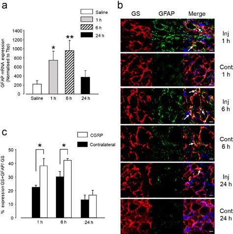 Satellite Glial Cells