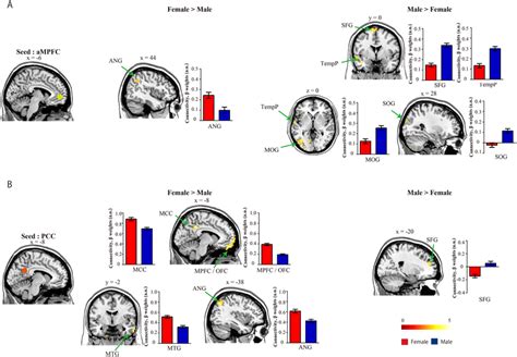 Seed Based Analysis Functional Connectivity Results A Comparison Of Download Scientific