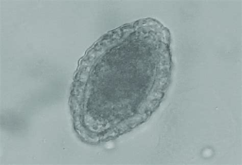 Dioctophyma Renale Biochemical And Biophysical Characterisation Of