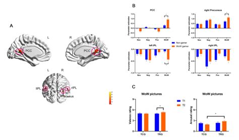 Cross Sectional Analysis Of The Fmri Paradigm Including Positive