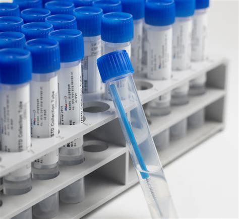 HPV STD Collection Kit 알엠 RM life