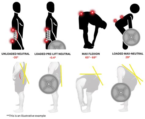 Supine Lumbar Flexion Measurement Of Segmental Lumbar Spine Flexion