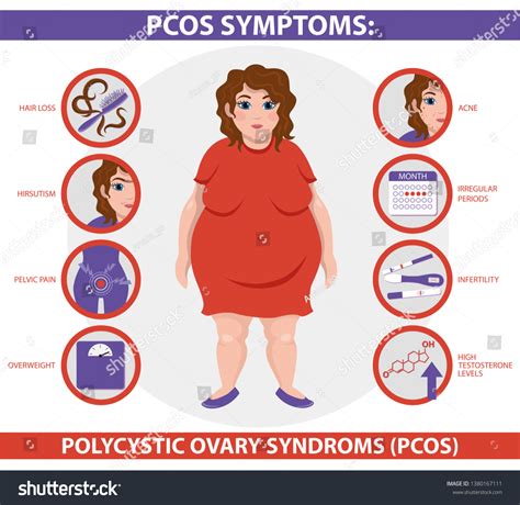 Pcos Patients