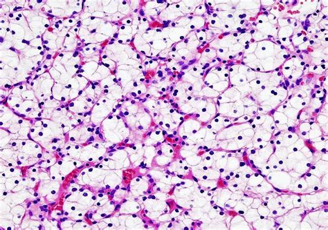 Hematoxylin Eosin