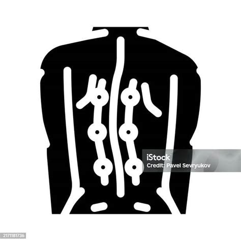 척추측만증 수술 수술 글리프 아이콘 벡터 일러스트 레이 션 건강 진단에 대한 스톡 벡터 아트 및 기타 이미지 건강 진단