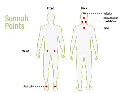 Cupping Points Sabinas Sunnah Clinic