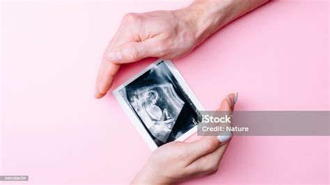 초음파 사진 임신 한 아기 사진 분홍색 배경에 초음파 임신 이미지를 들고있는 여성의 손 임신 출산 아기 출산에 대한 기대의 개념 임신에 대한 스톡 사진 및 기타 이미지