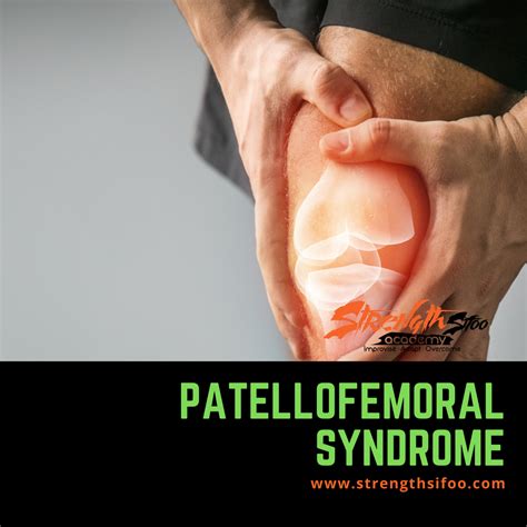 Patellofemoral Syndrome