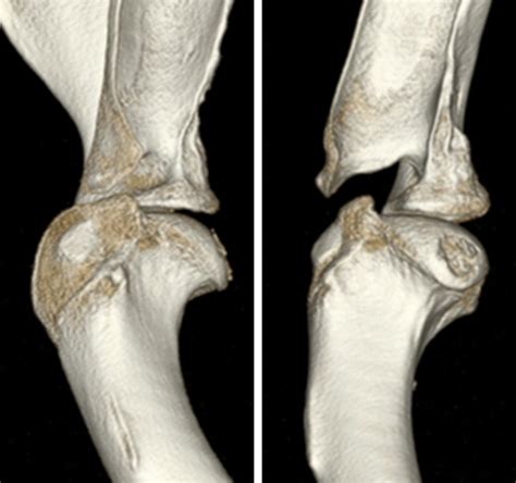 Joint Surgery Cpd Solutions Online Shop