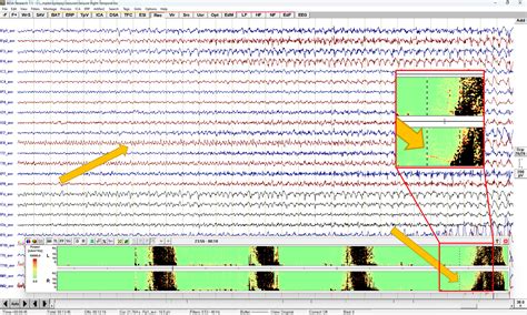 Besa® Brain Electrical Source Analysis Besa Research Besa Pipeline
