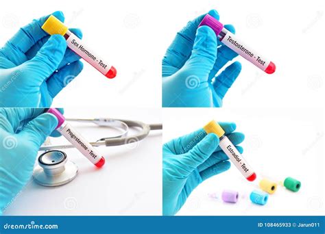 Blood For Sex Hormone Test Stock Image Image Of Hematology 108465933