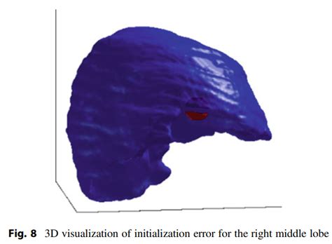 Automatic Initialization Of 3d Active Models For Lobe Segmentation In Thorax Ct Images Nuven