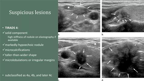 Imaging Of Thyroid Pptx
