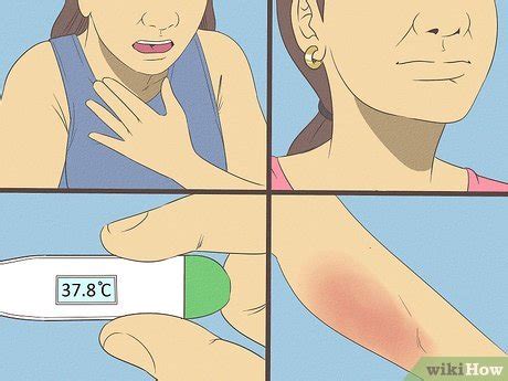 3 Ways To Get Rid Of A Rash WikiHow