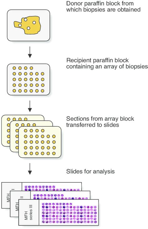 Schematic Presentation Of The Tissue Microarray Method Download
