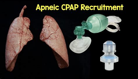 Rebel Cast Episode 25 Is Apneic Oxygenation Overhyped With Scott
