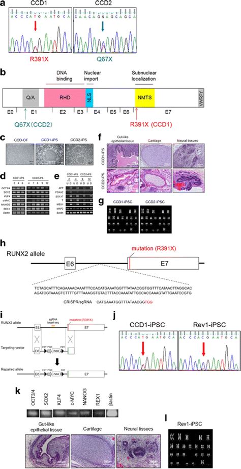 Generation Of Cleidocranial Dysplasia Ccd Patient Specific Ipscs And