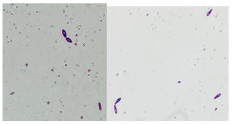 Microbiology Case Study Not All Gram Positive Bacilli From Positive