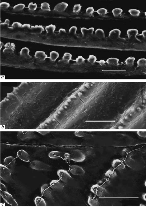Crest Teeth Of Sclerites Of Elasmoid Scales In Some Species Of Bony Download Scientific Diagram