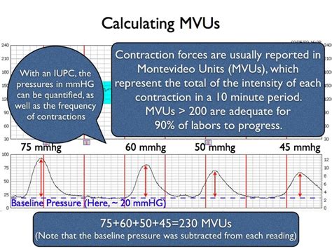 Basic Pattern Recognition Electronic Fetal Monitoring Fetal Heart