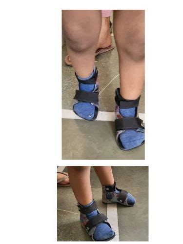 Foot Orthosis Supramalleolar Foot Orthosis Manufacturer From Surat