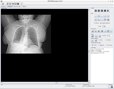 Broken Image Upon RetainLongFullDates Issue Fo Dicom Fo Dicom GitHub